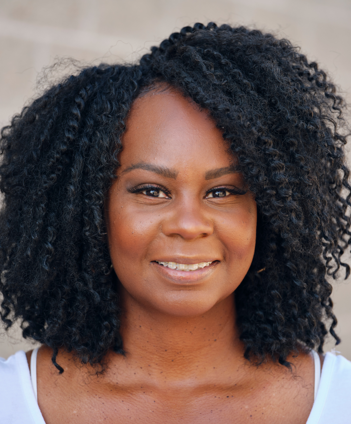 Deep Plane Neck Lift in Plano, TX | Brobst Facial Plastic Surgery
